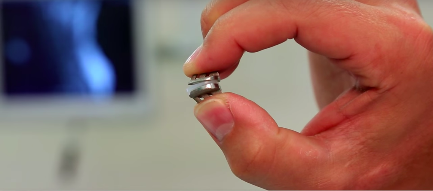 Total Disc Replacement | AVALA Spine