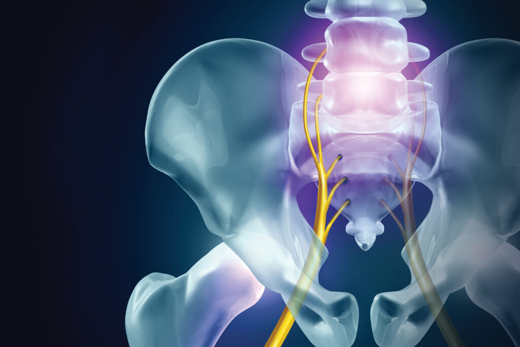 Back & Leg Pain | AVALA Spine